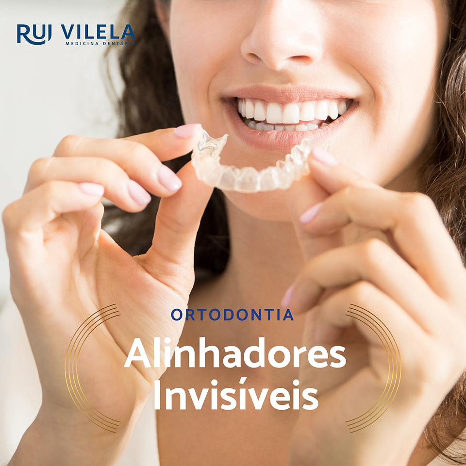 Alinhadores Invisíveis | ATRA